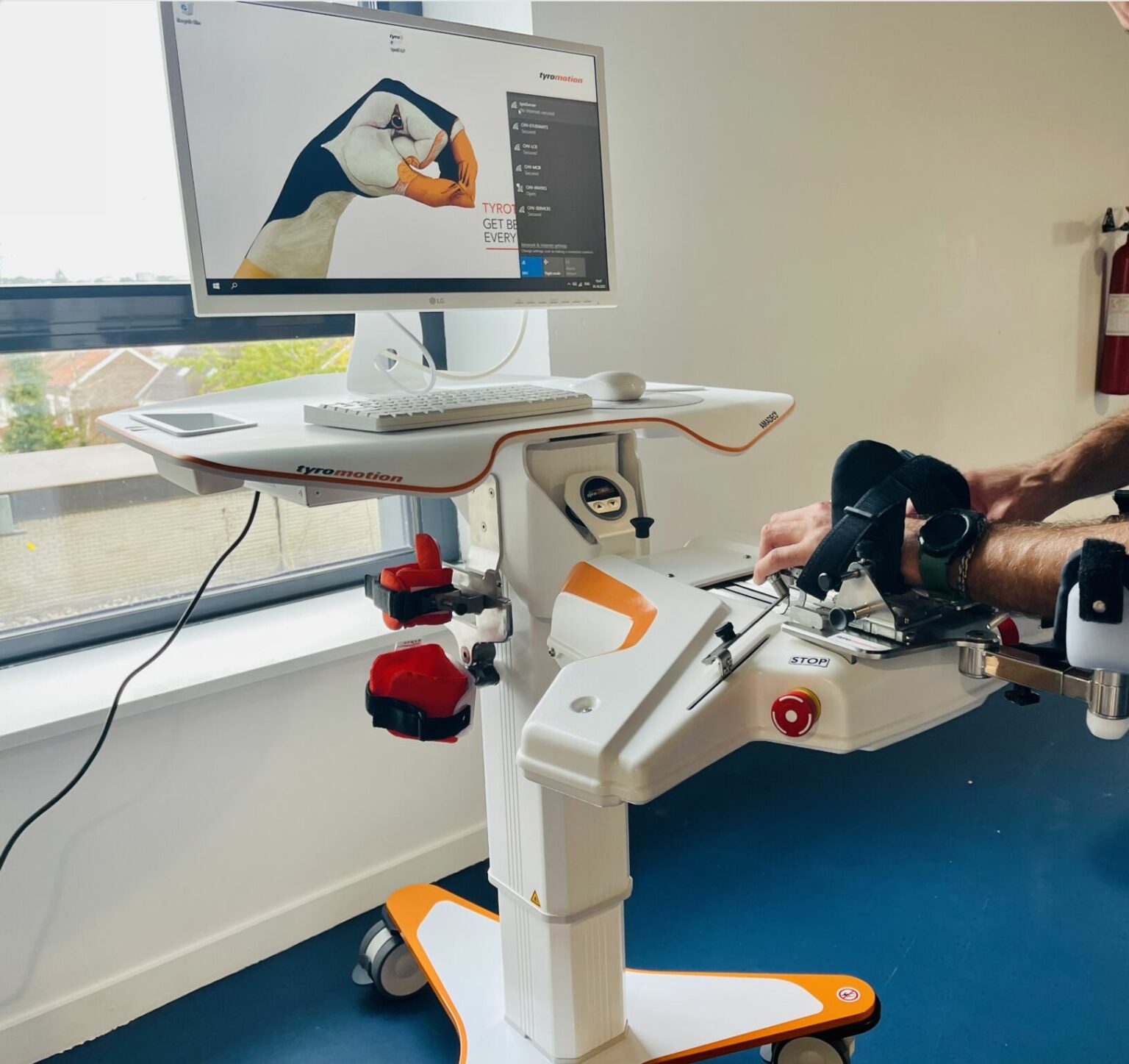 Chirurgie de la main et du poignet - SOS MAINS - CHV